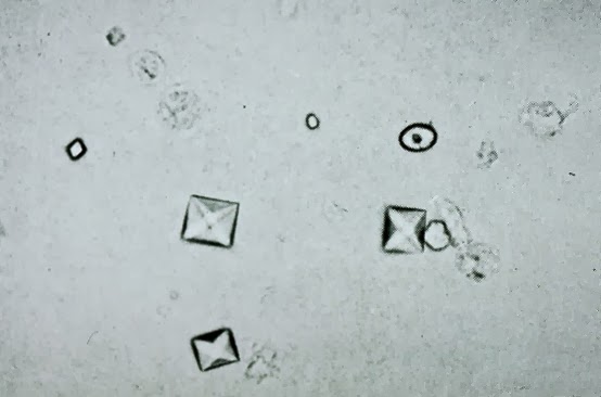 Acidose – Velkommen til studiehjelpen